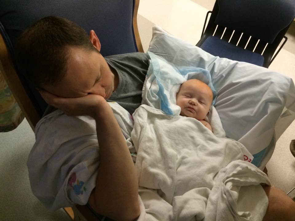 Hydrocephalus Before And After
